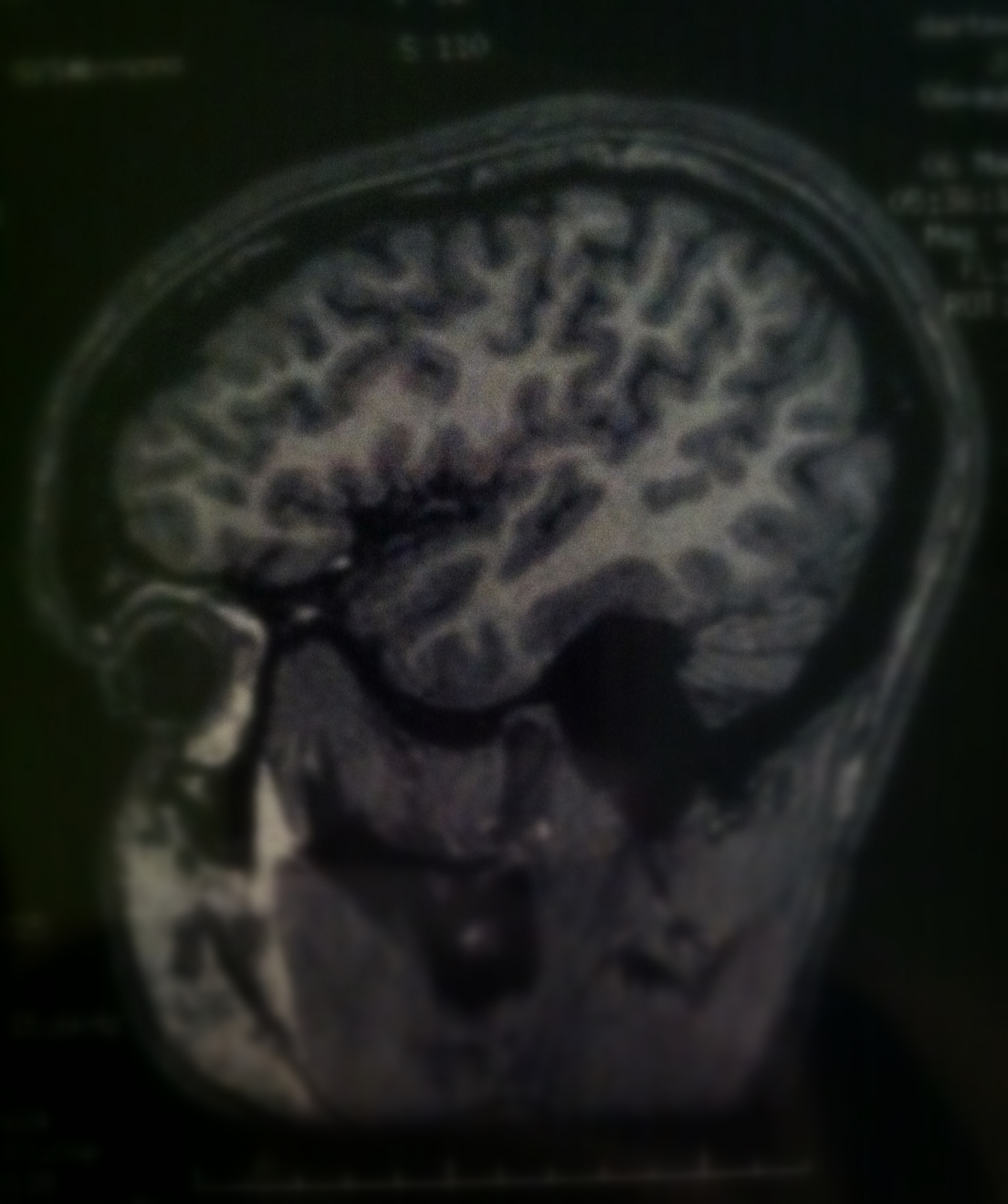 Addicted to Junk Food? 6 Ways to Hack Your Brain for Freedom from ...